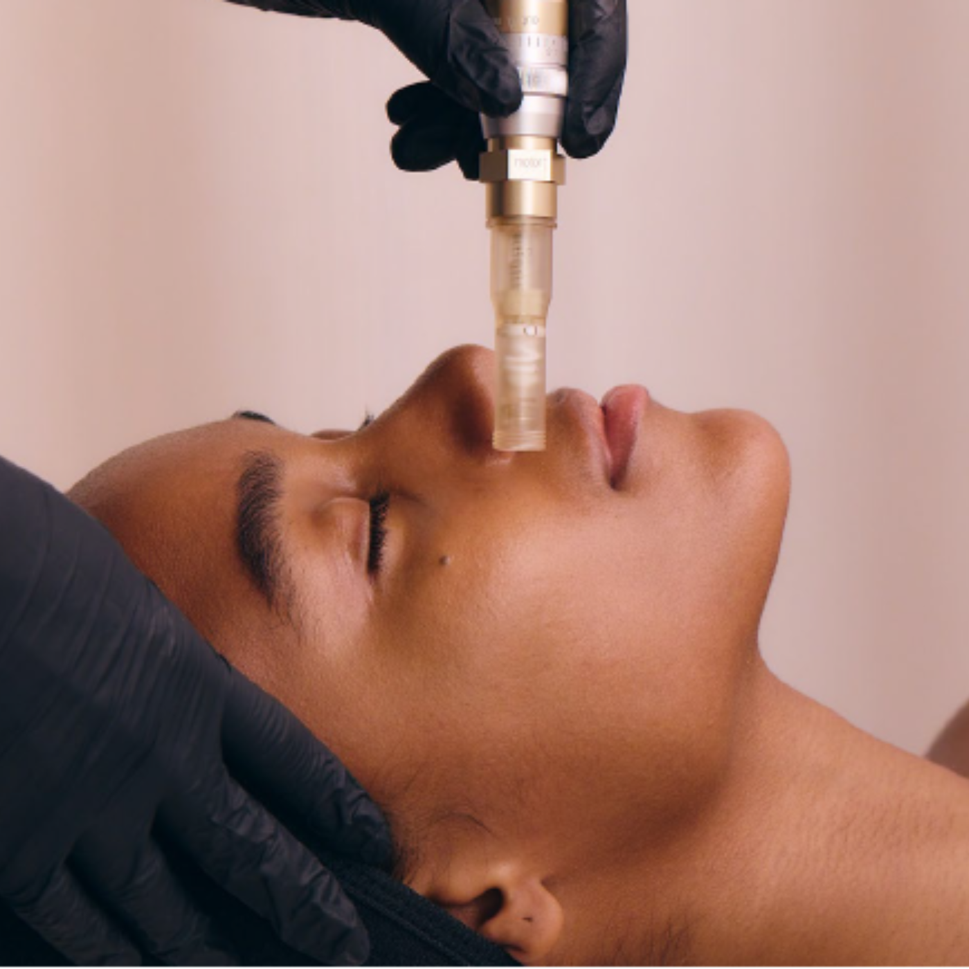 Nano-Needling | Ihloff Salon and Day Spa | Tulsa, OK